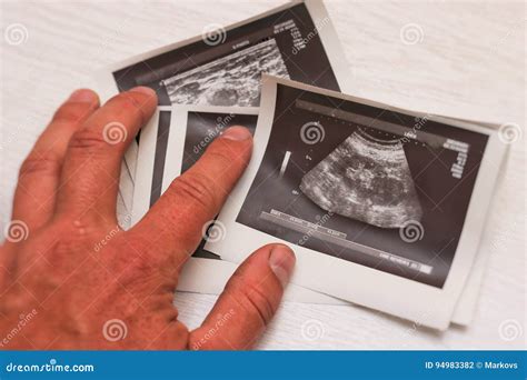 Fotos Do Ultrassom Foto De Stock Imagem De Hospital 94983382