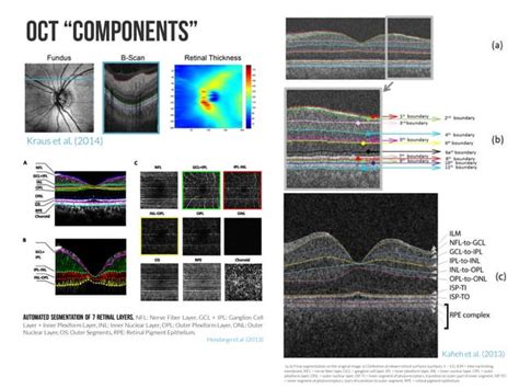 shallow introduction for deep learning retinal image analysis ppt