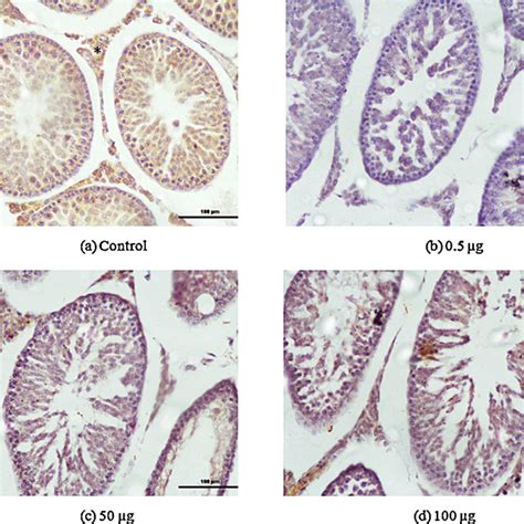 Photomicrograph Of Testis Showing Immunohistochemical Localization Of Download Scientific