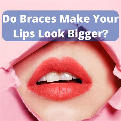 How To Make Your Lips Look Bigger With Braces