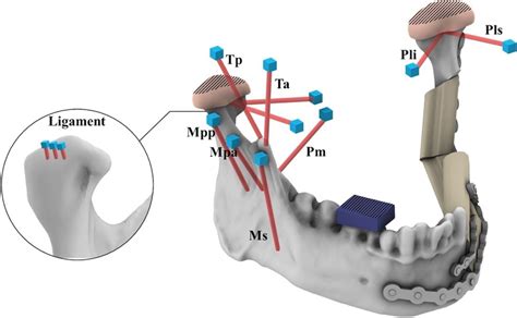 Loading And Boundary Constraints On The Mandible Ms Superficial