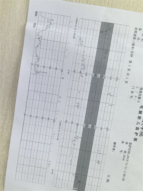 胎儿宫内窘迫病例一例 医联