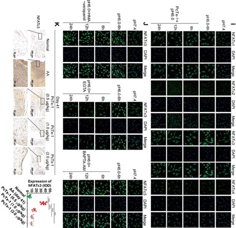 Asic1a Induces Nuclear Translocation Of Nfatc3 By Mediating Ca 2 Download Scientific Diagram