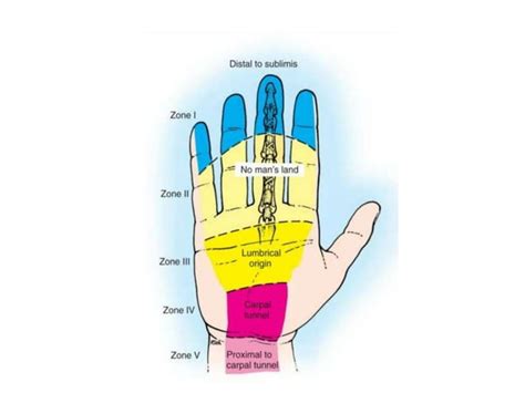 Tendon Injuries Of Hand Pptx