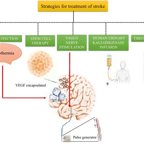 A Concise Overview Of The Pathophysiology Of Stroke Excitotoxicity In