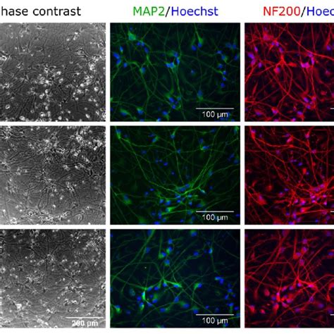 Neuronal Differentiation Of Hnscs After Bio Electrospray Assessed By