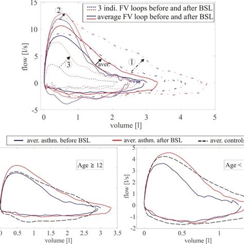 Spirometric And Eit Derived Fv Loop Of One Representative Asthmatic