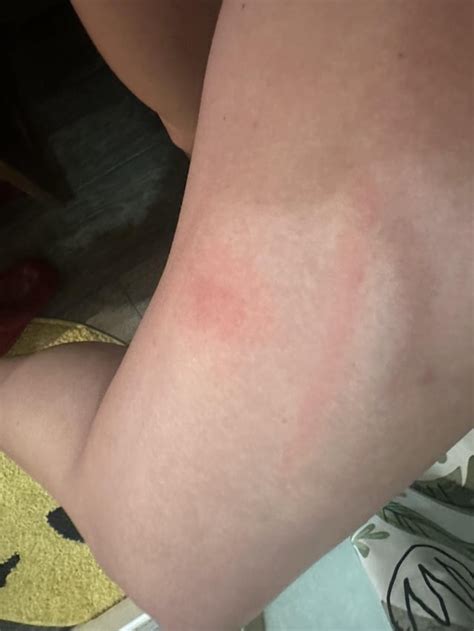 Bite From Cicadia Killer Ryiffbite