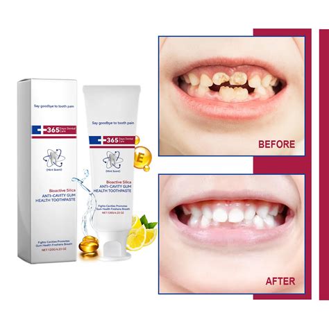 Easy To Use Gum Health Toothpaste Tooth Color Correction Toothpaste