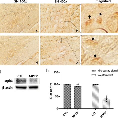 Dopaminergic Cell And α Synuclein α Syn Expression In An Mptp Induced Download Scientific
