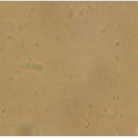 B Actinomyces Naeslundii Api 20a The Organism Is A Small Gram