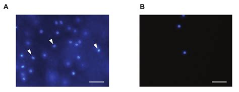 Isolation Of Adipose Tissue Nuclei For Single Cell Genomic Applications