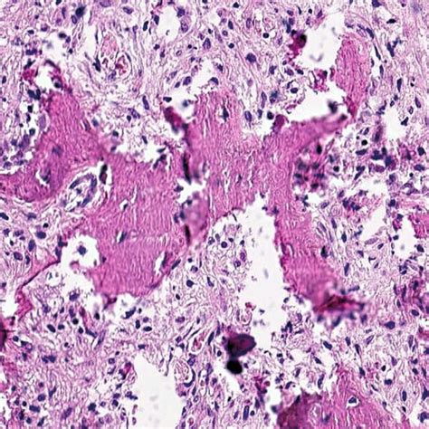 Histologic Findings Hematoxylin And Eosin Staining X20 Of The