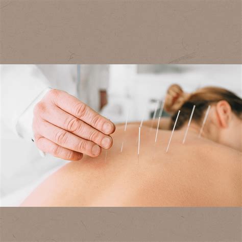 Acupuncture Massey Physio Therapy