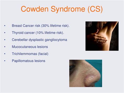 Ppt Introduction To Cancer Genetics And Genomics Powerpoint