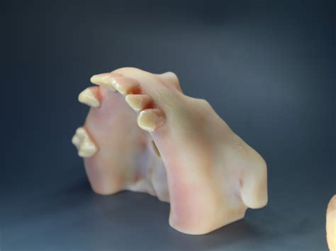 Maxillary Extraction W Sinus Cavity And Pulp — Biomed3d