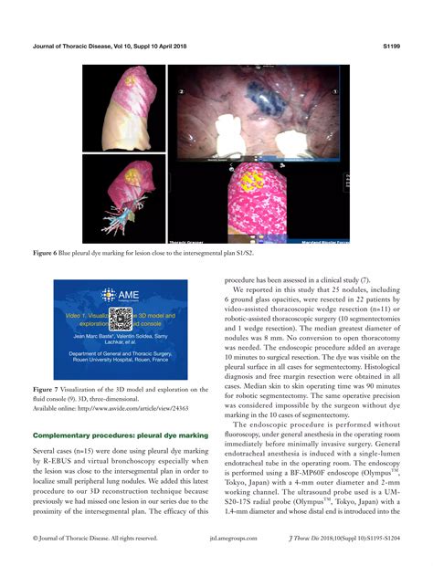 Study Development Of A Precision Multimodal Surgical Navigation System