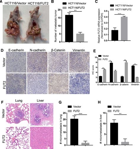 Fut2 Overexpression Decreases In Vivo Crc Emt And Metastasis A