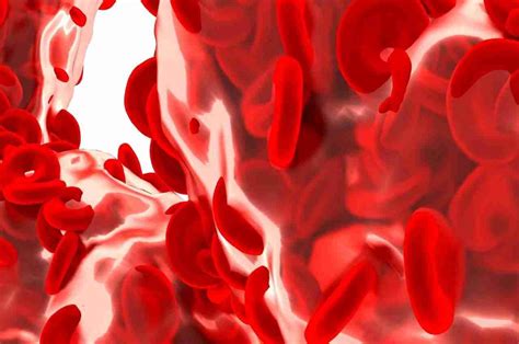 Hypertriglyceridemia Elevated Triglycerides Levels Causes Hypertriglyceridemia Elevated Triglycerides Levels Causes