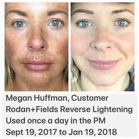Amanda Beaudette On Linkedin Transformationtuesday Because Rodan Fields Reverse Regimen Is