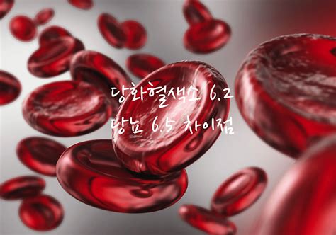 당화혈색소 62 당뇨 65 차이
