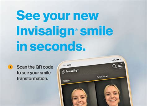 Have You Tried The Smileview Experience From Invisalign Seasons Of