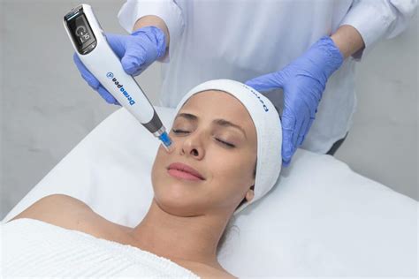 Rejuvenate Your Skin With Dermapen Advanced Skin Needling Technology