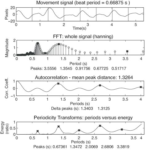 4 Fft Analysis Zero Padded Whole Window Analysis Using Hanning