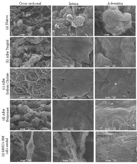 Sem Imaging Showed The Effects Of The Most Important Step Of The