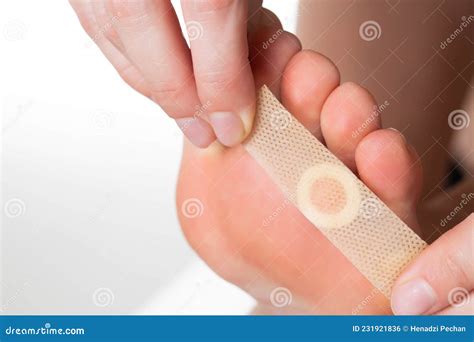 Callus On Leg Girl Uses Ointment Band Aid And Bandage To Treat