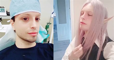 엘프가 되기 위해 계속해서 성형 수술을 하고 있는 청년의 충격적인 미모 오펀 디스커스