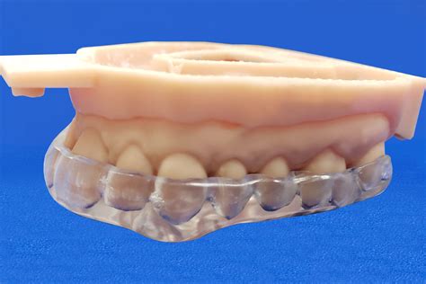 Surgical Splint Dental Code At James Overton Blog