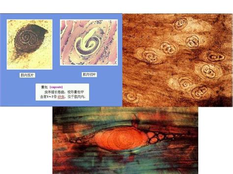 旋毛虫囊包手绘图标注 图库 五毛网