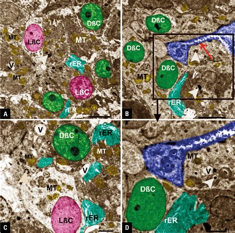 Figure 2 From Transmission Electron Microscopic Investigation Of The