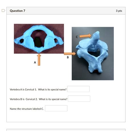 Solved Question 7 3 Pts B Vertebra A Is Cervical 1 What Is Its