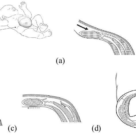 Fig1 The Description Of The Components Separation Technique In