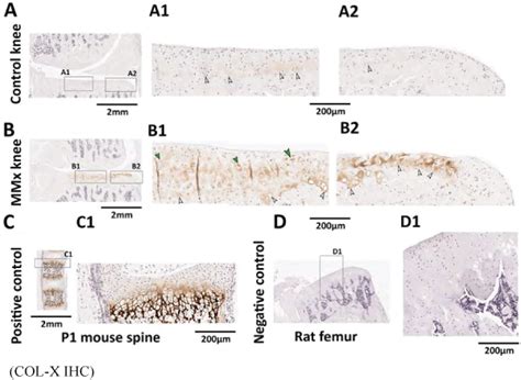 Ihc Of Col X In The Articular Cartilage Control A And Mmx B Knee