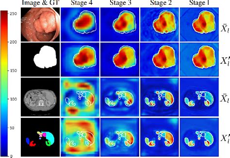 Figure 1 From Global And Local Feature Reconstruction For Medical Image Segmentation Semantic