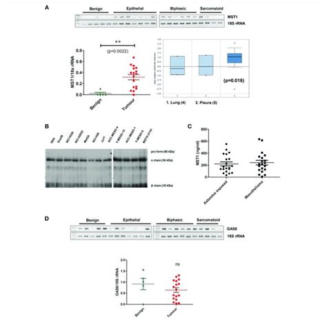 Levels Of MST1 Are Significantly Elevated In MPM Tissue Vs Benign Download Scientific