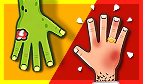 Extreme Hand Slap (by RHM Interactive) - play online for free on Yandex Games