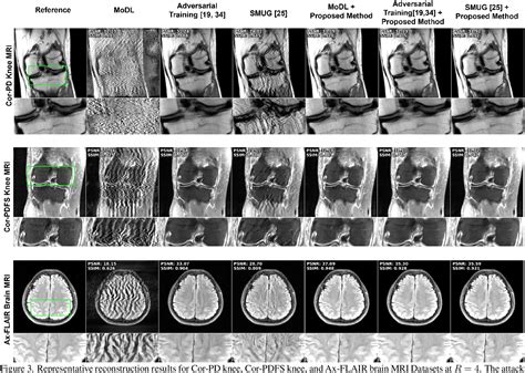 Detecting And Mitigating Adversarial Attacks On Deep Learning Based Mri Reconstruction Without