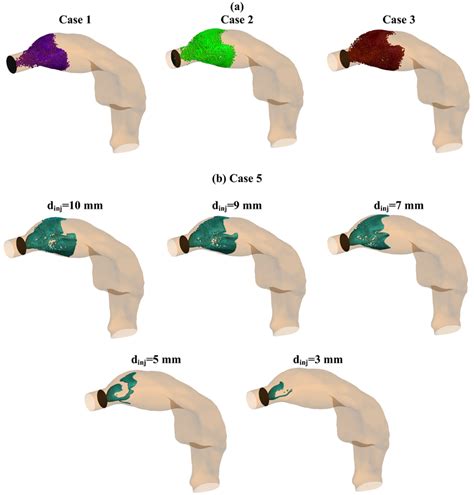 A Particles Injection In Different Planes Sn 02 B Injection Of