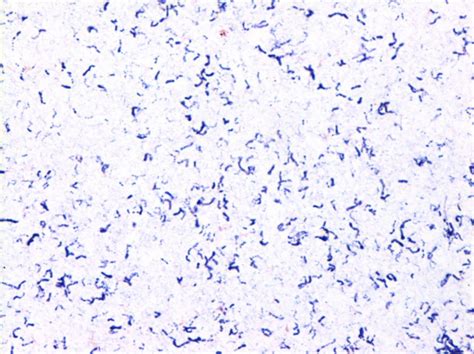 Mycobacterium Lablogatory