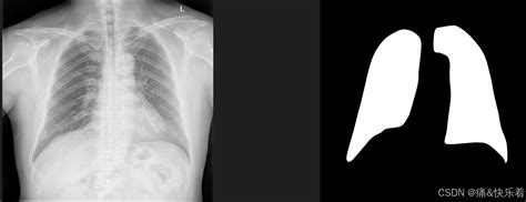 深度学习之基于pytorch框架的unet分割模型搭建学习 unet模型搭建 csdn博客