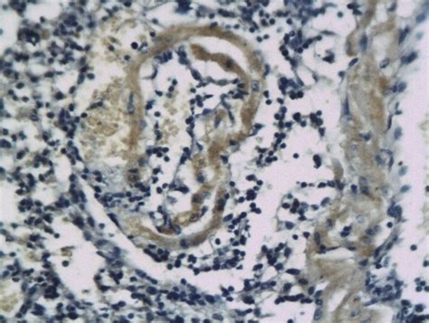 Sstr2somatostatin Receptor 2 Polyclonal Antibody Bs 1138r