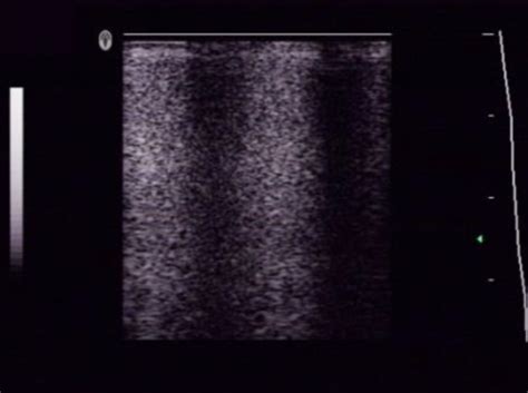 Spi Practice Test A Flashcards Quizlet