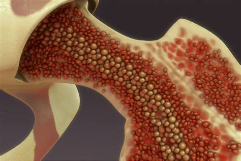 Producción De Eritrocitos En La Médula ósea Homo Medicus