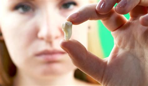 Tooth Extraction Procedure And Aftercare Delight Dental Smiles