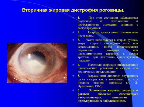 Дистрофии роговицы глаза презентация онлайн