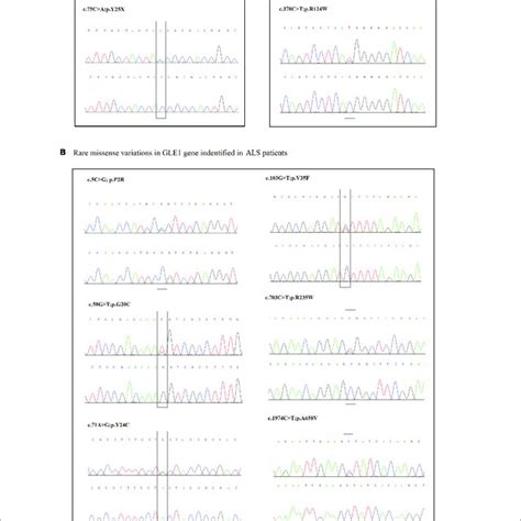 A The Sanger Sequencing Of The Lof Variant Identified In Sals